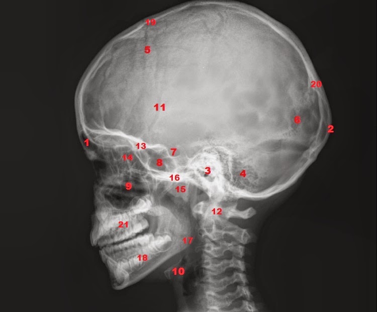 E-Anatomía Odontológica: Radiografía lateral grupo 6