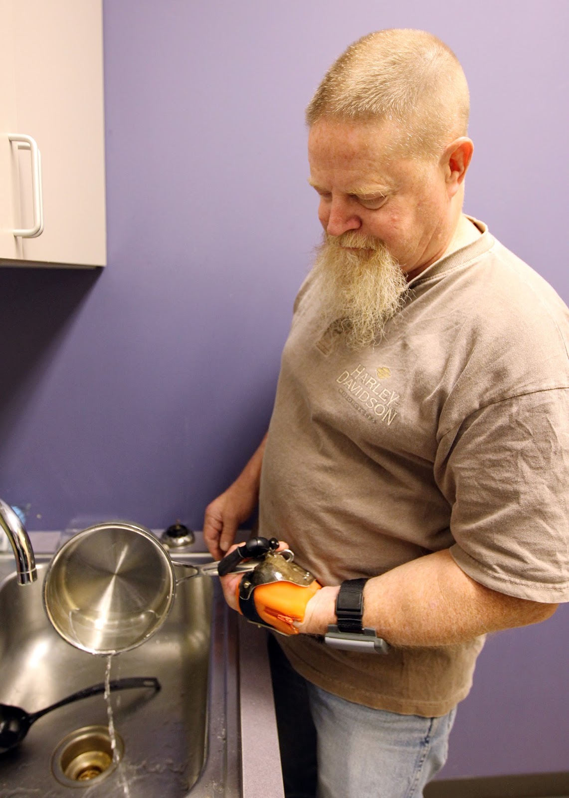 Mark Kodiak Ukena: Adam Pringle and his Bionic Thumb at Dynamic Hand ...