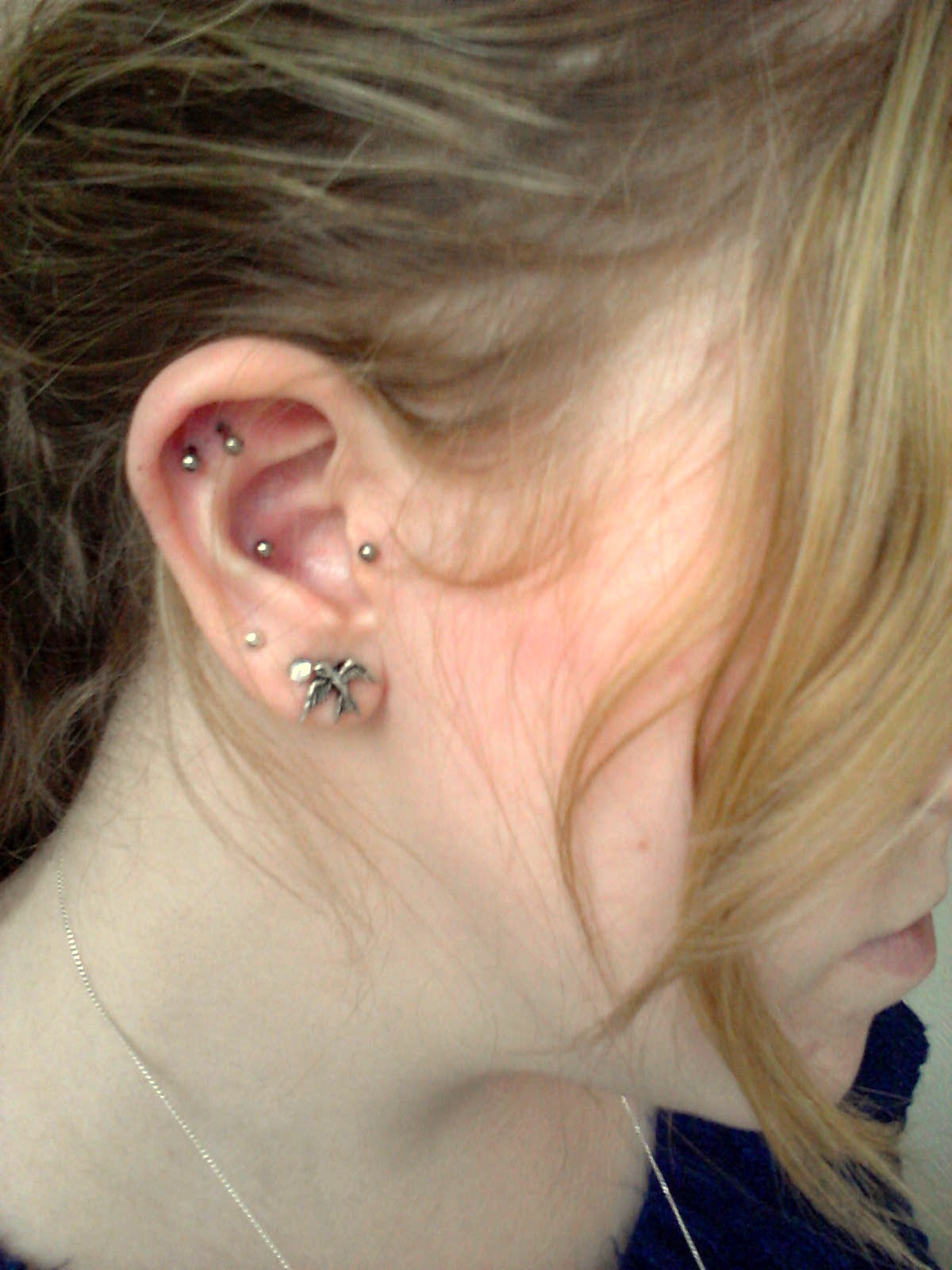 My Jaw Surgery: 15th Piercing - yay