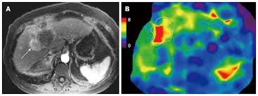 MRI: My Radiology Insight