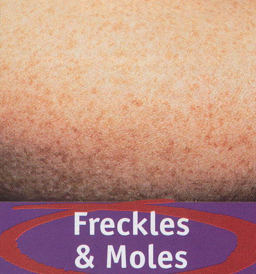 Wesley Corporate Health Blog: Skin Cancer Facts