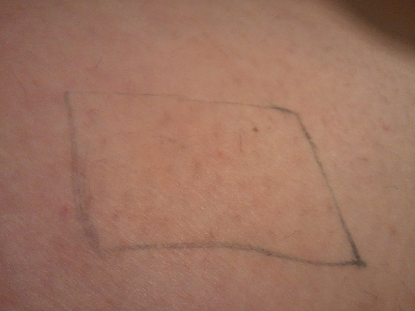 Copaxone Reactions: The Good, The Bad and the Ugly