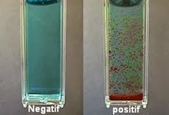 KIMIA ORGANIK 2: UJI KARBOHIDRAT