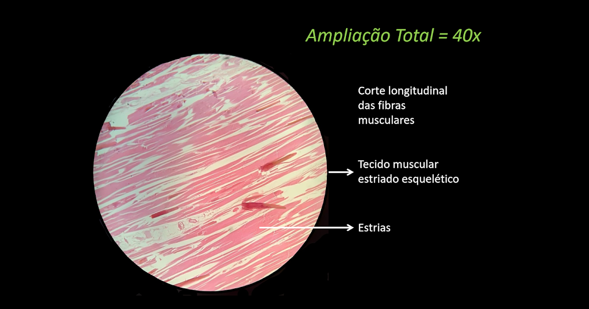 Histologia e Embriologia: Músculo Estriado Esquelético