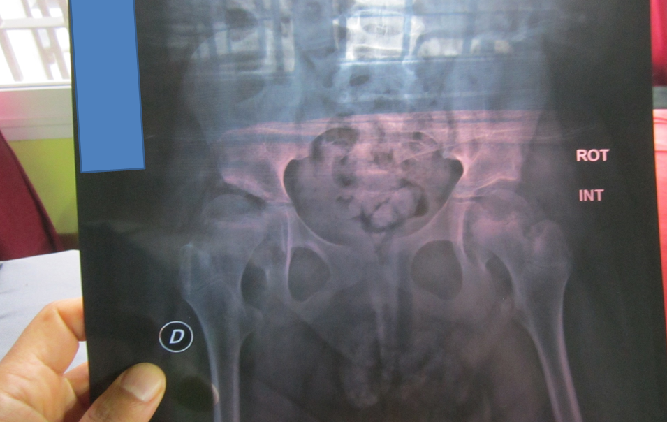 The Fascia Therapy Blog