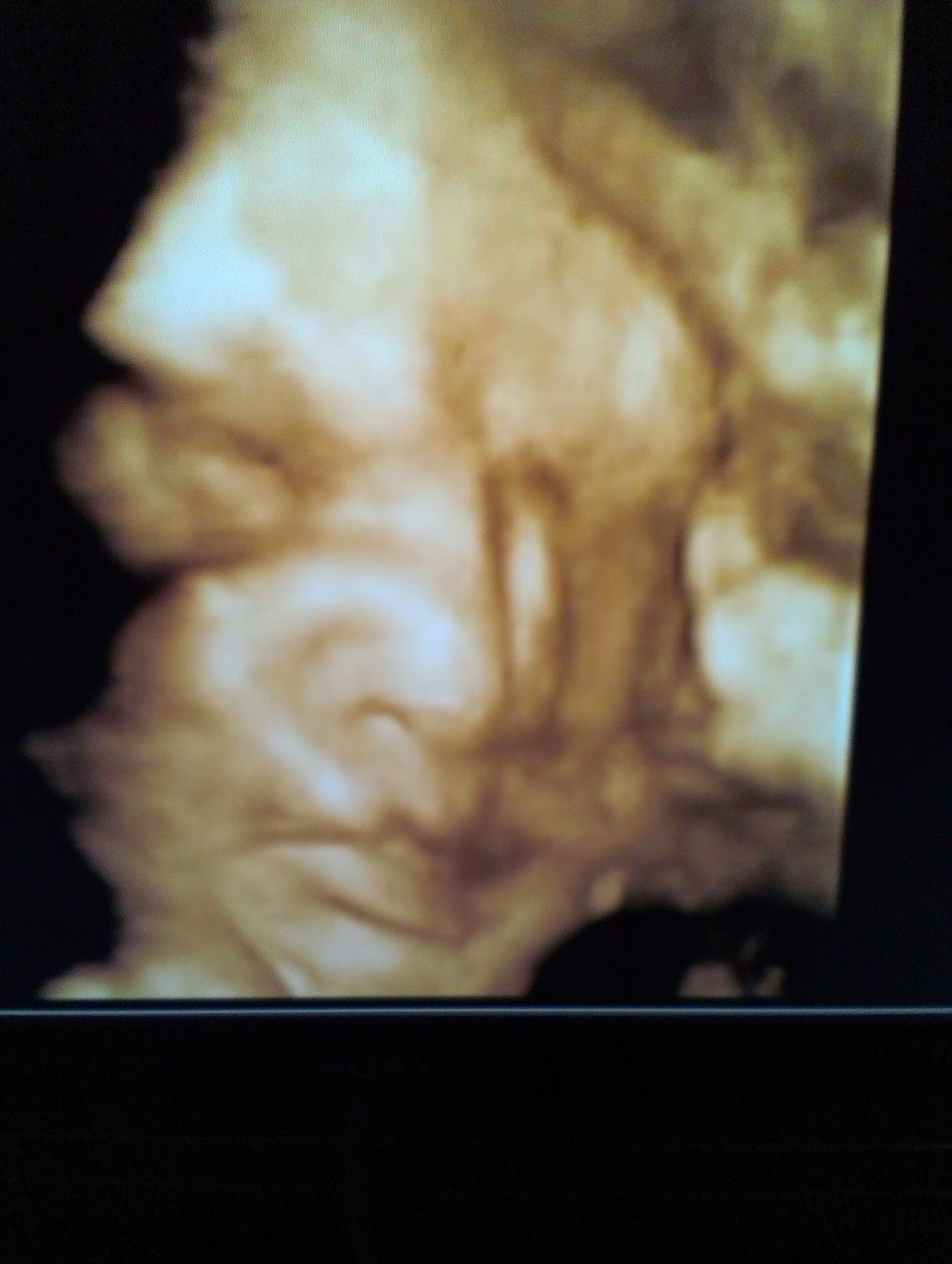 AnnaleighNicolePascal: Pregnancy Series:Our 3D Baby Scan