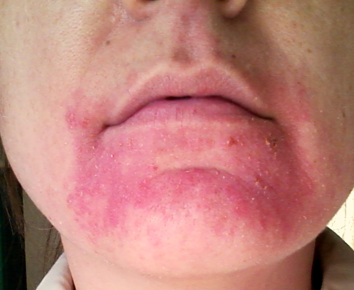 Gold Country Meets Big Sky: Creeping Creature from the Crusted Yellow ...