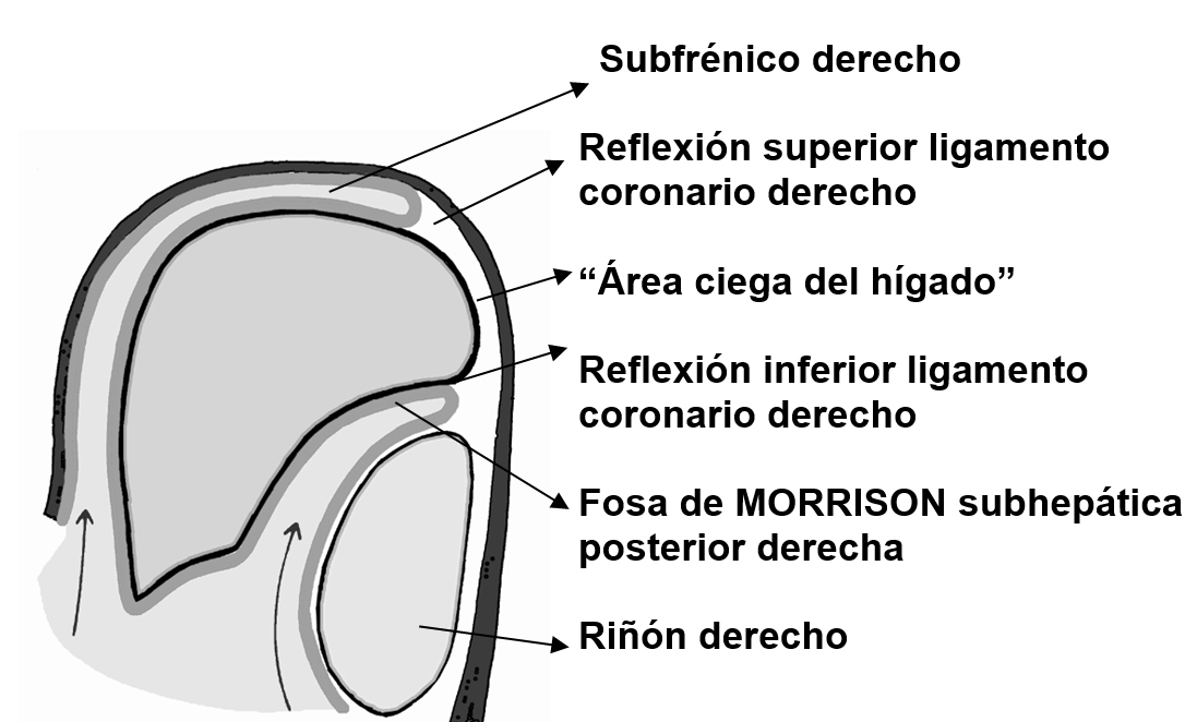 TecniScan Científico: Espacios Perihepáticos, Transcavidad de los ...