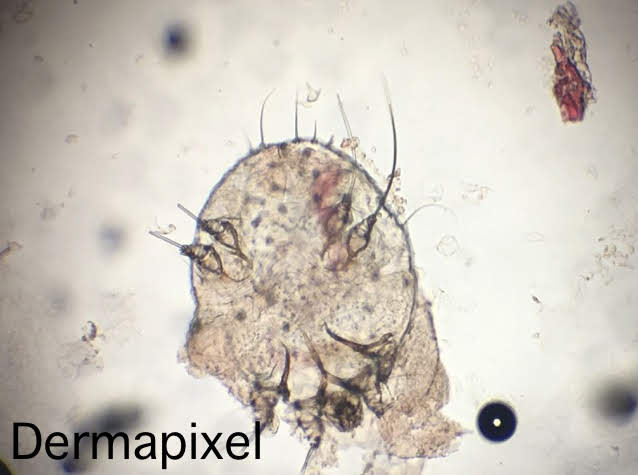 Dermapixel: abril 2019