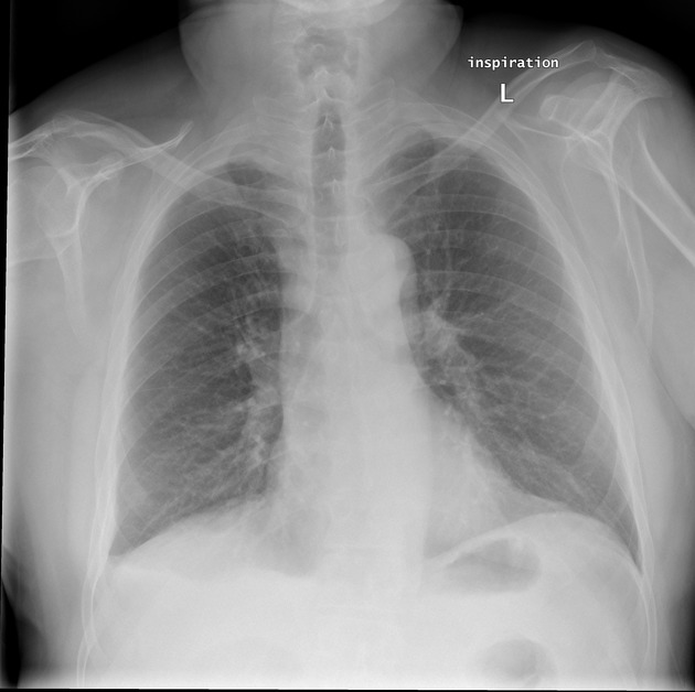 Radiologi Thorax X-Rays Postero-Anterior | Dokter Alfa : Belajar Kedokteran