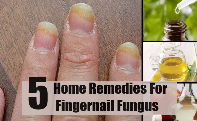 The Healthy Tips: 5 Home Remedies For Fingernail Fungus