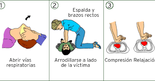 PRIMEROS AUXILIOS: RCP (REANIMACIÓN CARDIOPULMONAR)