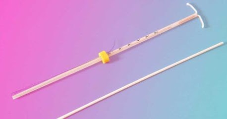 Decidual Cast Pictures, Size, Birth control, Miscarriage - Health Care ...