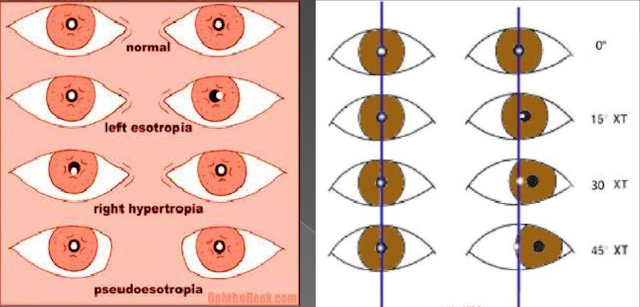 Cátedra N° 07 - Cover test