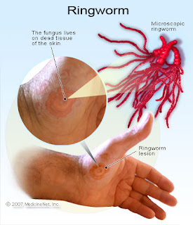 GHS 320- Environmental Health