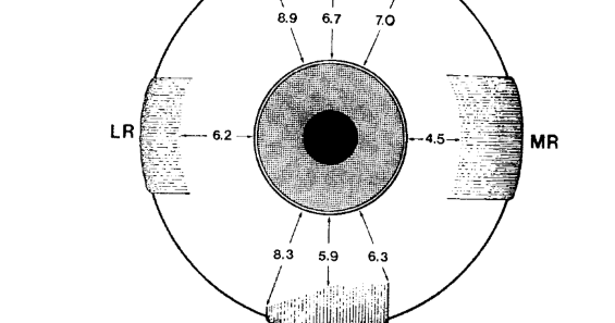 Músculos extraoculares