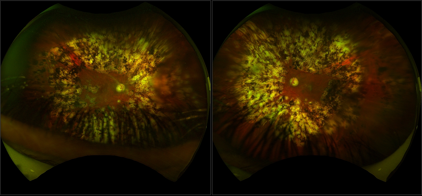 Sonoran Desert Eye Center: 2018