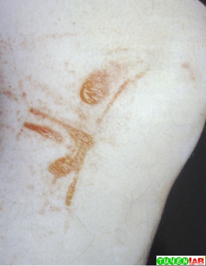 [Dermatology] Atlas of Contact Dermatitis | Free Medical Atlas