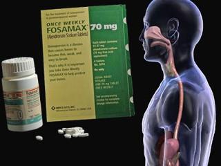Fosamax Bone Fractures Blog
