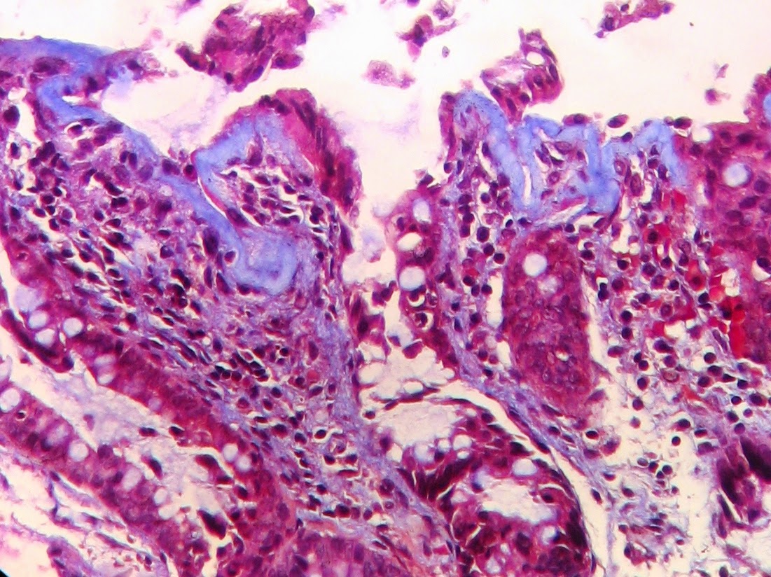 GASTROINTESTINAL AND LIVER HISTOLOGY PATHOLOGY ATLAS: COLON ...