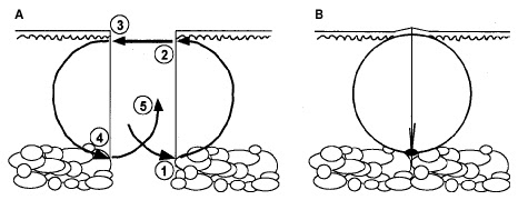 Doctors Gates: Indication and Technique of Buried Intradermal Sutures