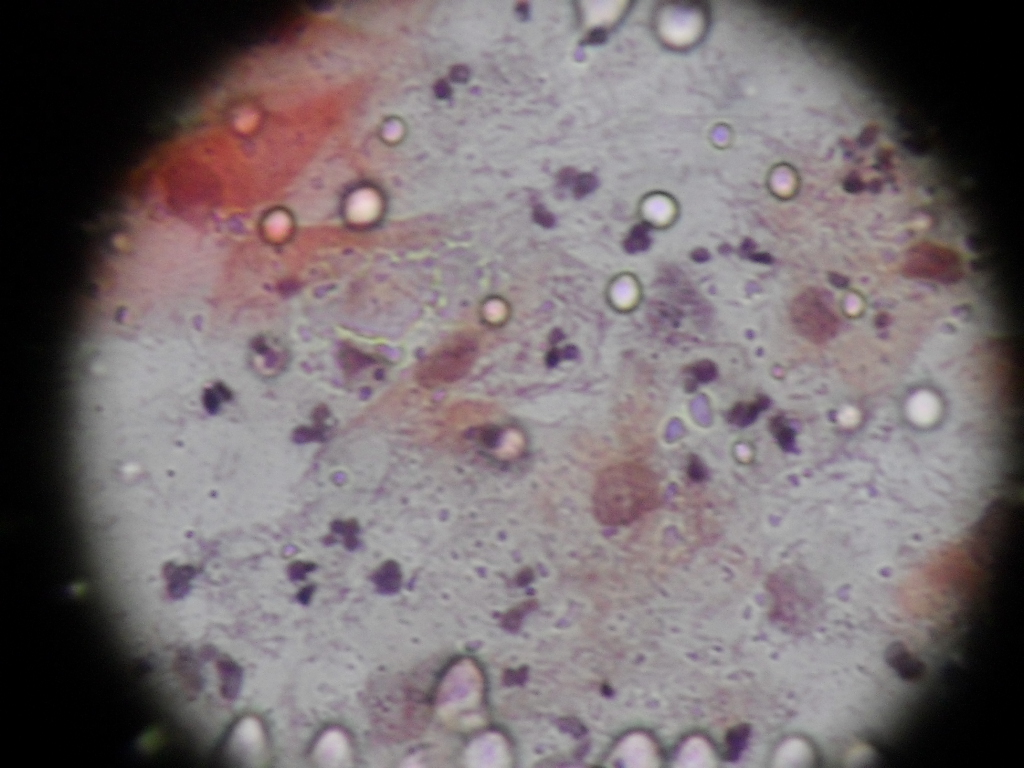 Citologia Clínica - 2011: Junho 2011