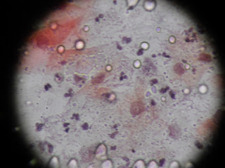 Citologia Clínica - 2011: CITOLOGIA VAGINAL