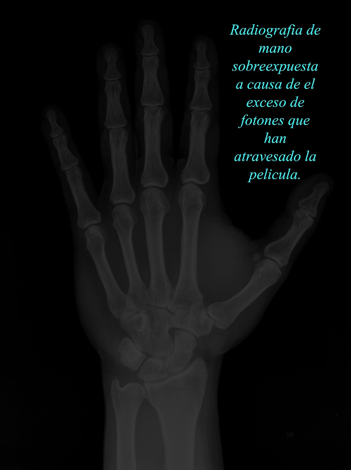 Radiología y Física Médica U.de Chile 2013: julio 2013