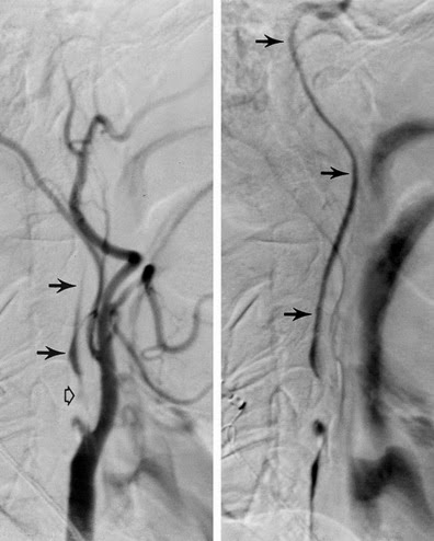 Ultimate Radiology : 'Semiology' - The Signs in Radiology