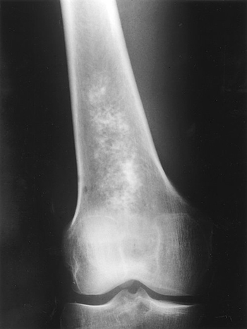 EL RINCÓN DE LA MEDICINA INTERNA. juanpedromacaluso@yahoo.com.ar ...