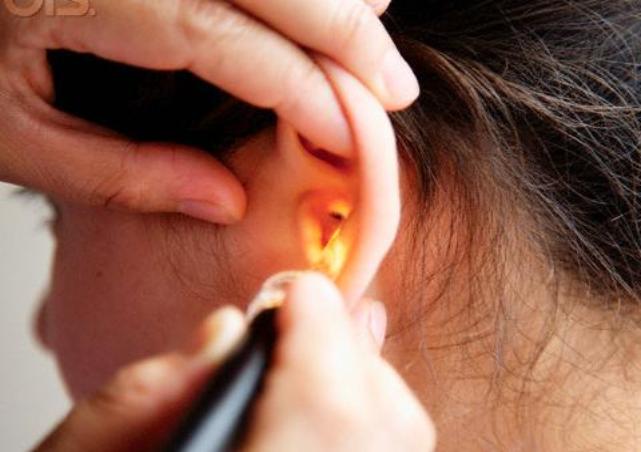 6 Ciri Ciri Penyakit Infeksi Telinga ~ Daun Sirsak