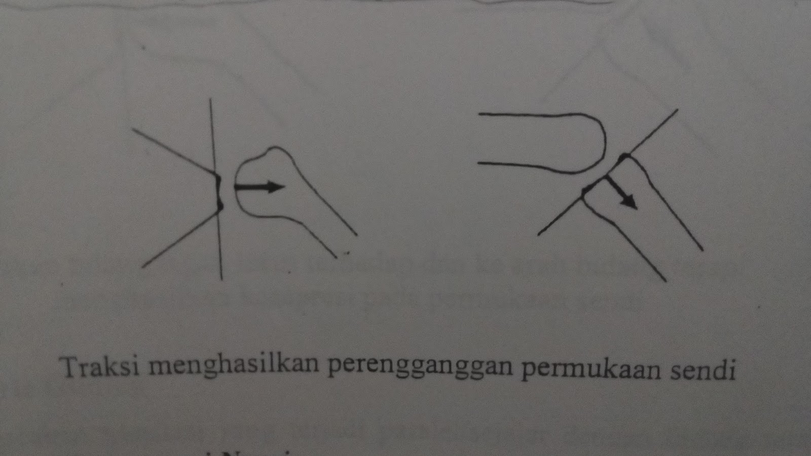 Fisioterapi: Joint Play