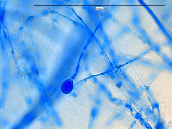 Fun With Microbiology (What's Buggin' You?): Sepedonium species