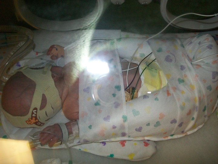 Frog In Stitches: Avoiding NICU head aka Plagiocephaly