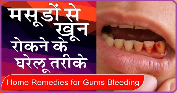 मसूड़ों से खून रोकने के घरेलू उपचार आयुर्वेदप्लस