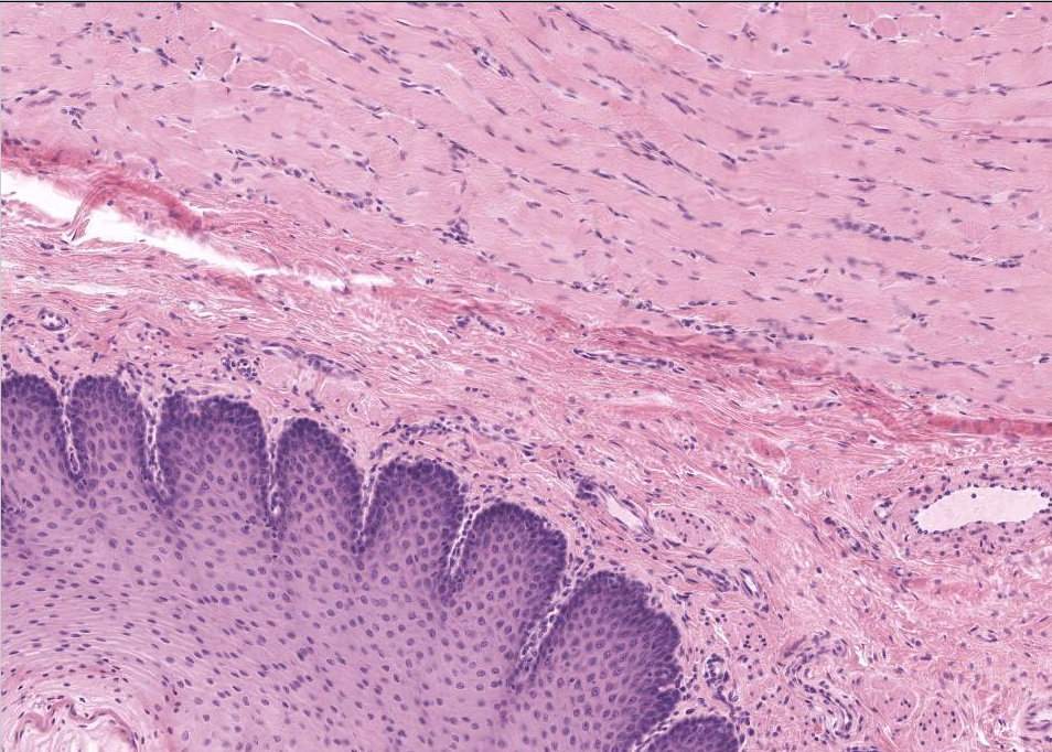 μicroscopia: TRACHEA, ESOFAGO E TIROIDE
