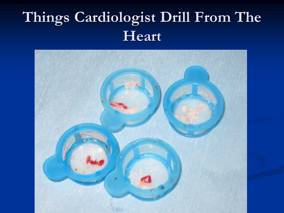 CVT Mohd Farid: Coronary Artery Disease CAD Part I-Credit Dato' Dr ...