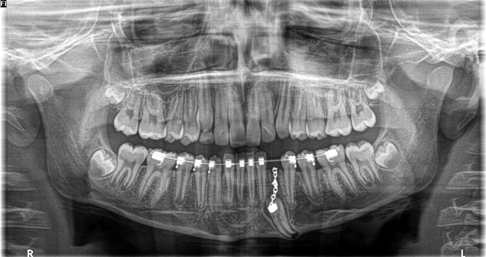 Dr Mogre Oral Facial Surgery Blog: 2016