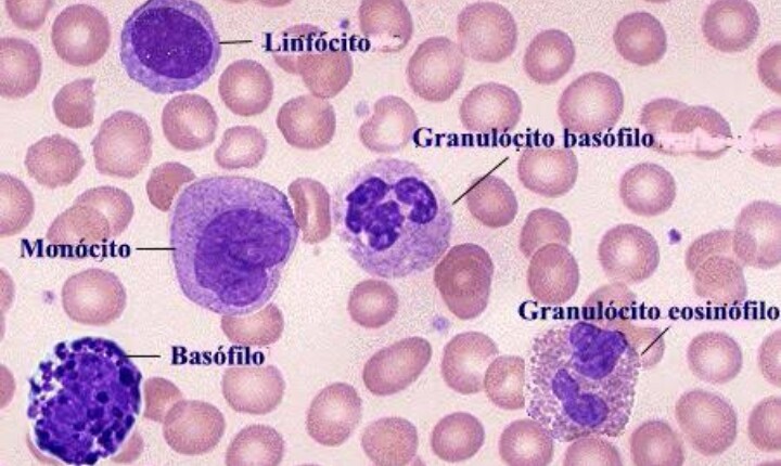 Hemácias Piradas: Hematologia : Hemácias e contagem diferencial...