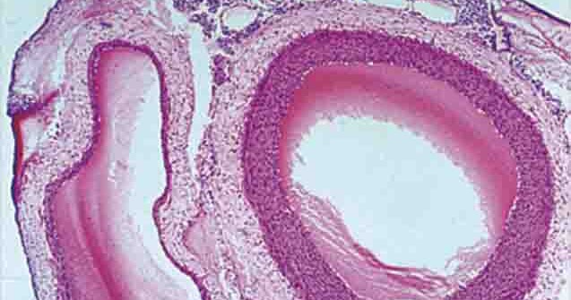 10 Perbedaan Arteri Dan Vena