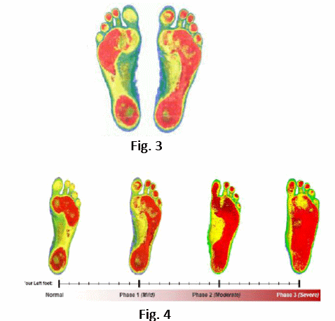 Dr. Tim Maggs: What is Your Child's Foot Type?