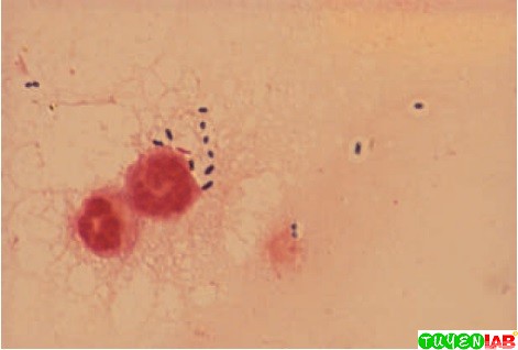 [Microbiology] Atlas of Infections of the Central Nervous System | Free ...