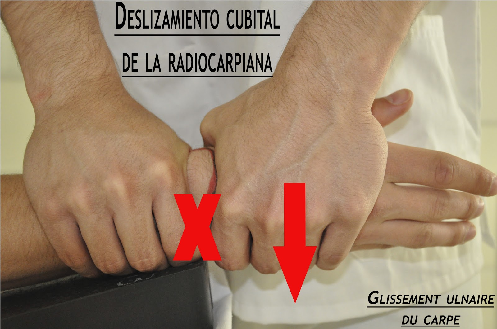 Érase una vez..tu radiocarpiana y sus huesitos: La radiocarpiana...eso ...