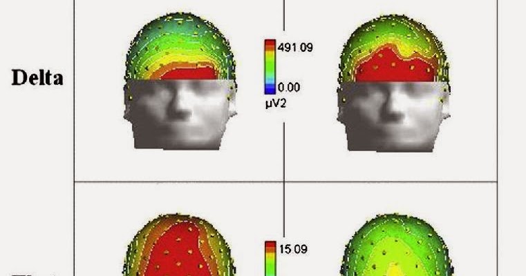 Neuroshaping: The EEG view of the default mode network