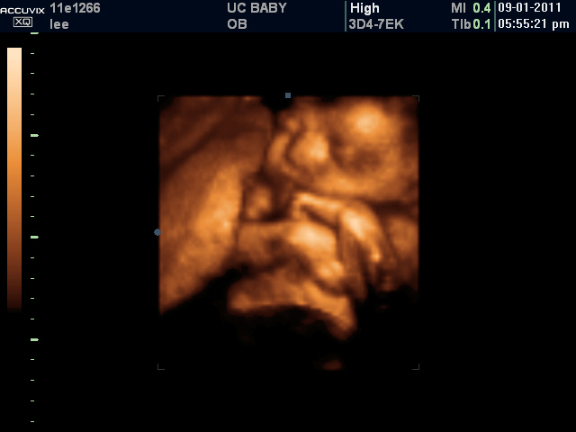 Kate & Nate: Parents In Waiting: 3D Ultrasound - 26 Weeks & 29 Weeks