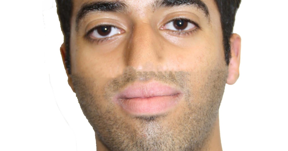 alyxrebeccaglazer:portfolio: Weird and Wonderful Deformed Faces