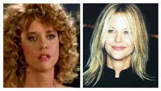 Meg Ryan Plastic Surgery Before and After Facelift and Botox - Star ...