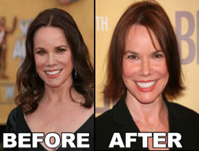 Barbara Hershey Plastic Surgery Disaster Photos Facelift, Botox ...