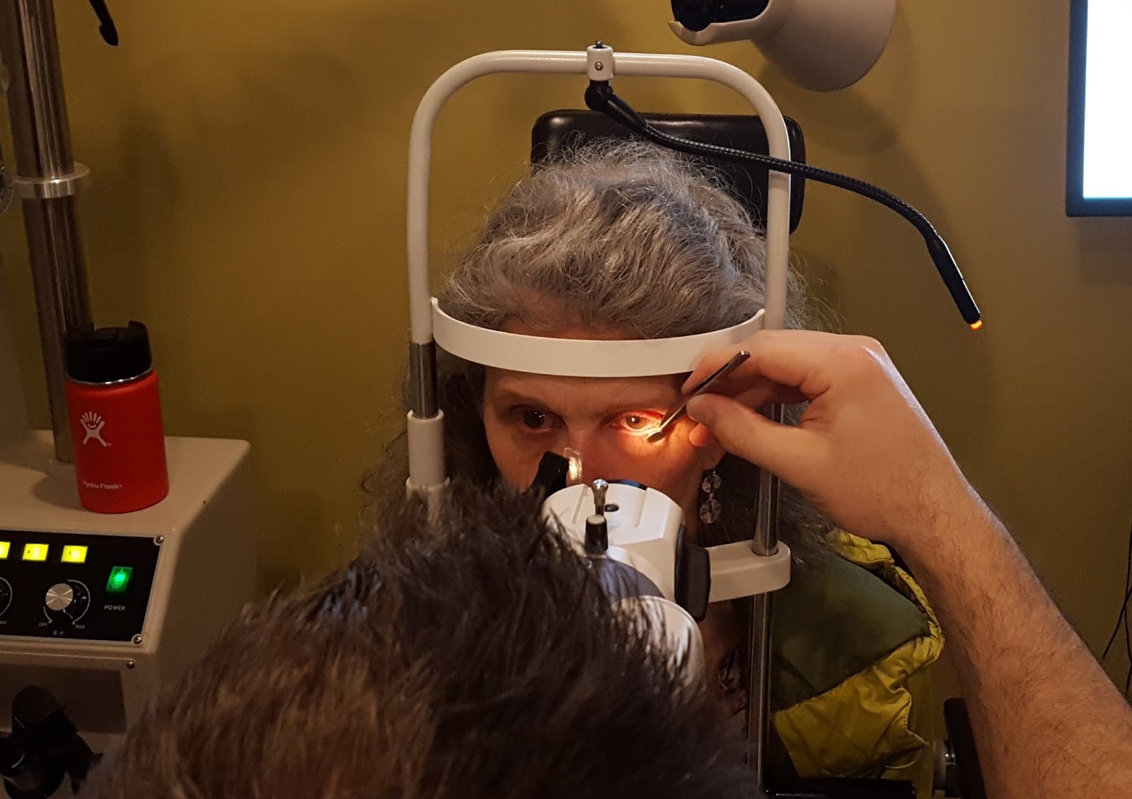 On Point: Dry Eyes: Part Six, TearCare