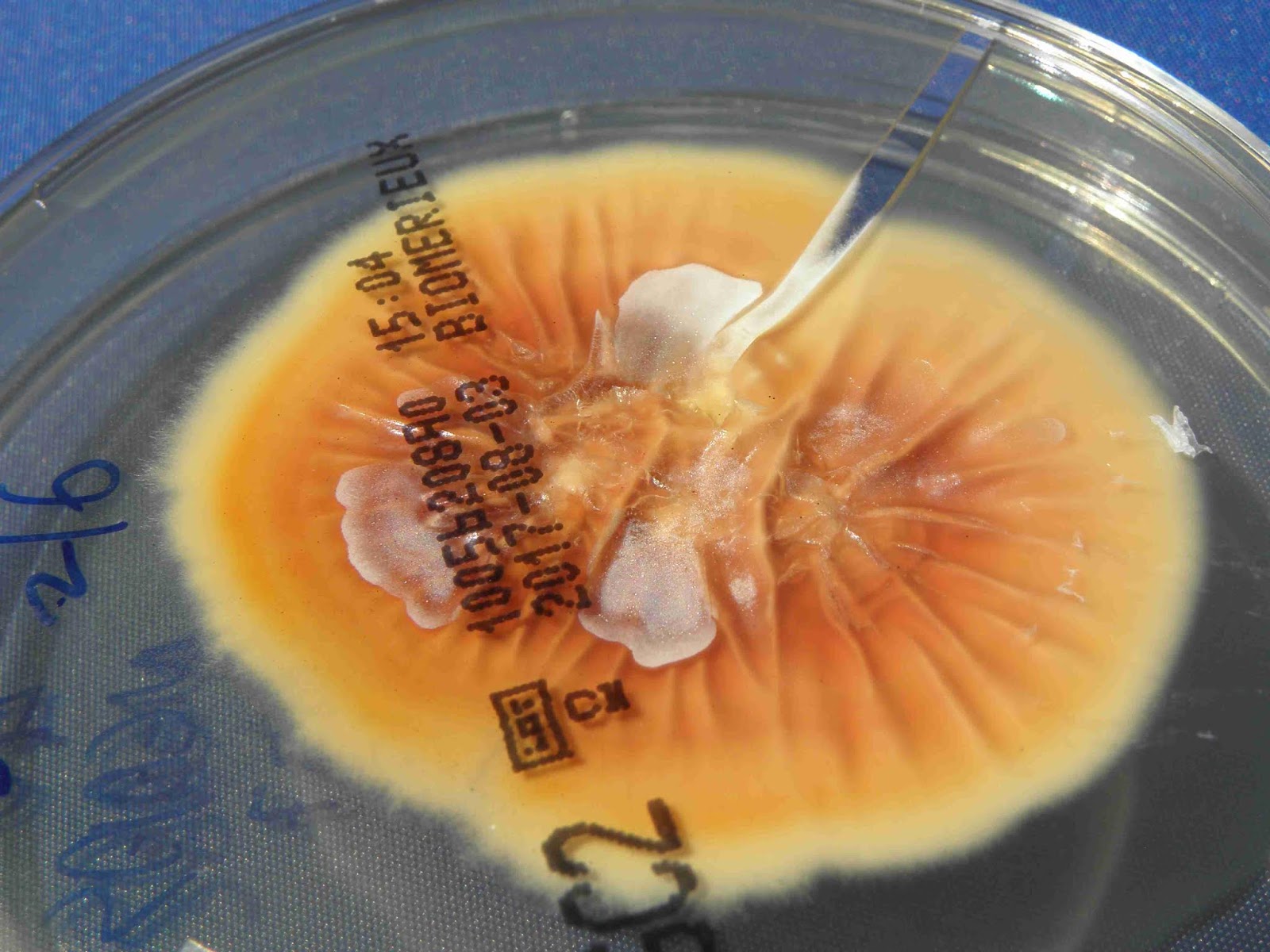 ATLAS MICOLOGIA: ASPERGILLUS VERSICOLOR
